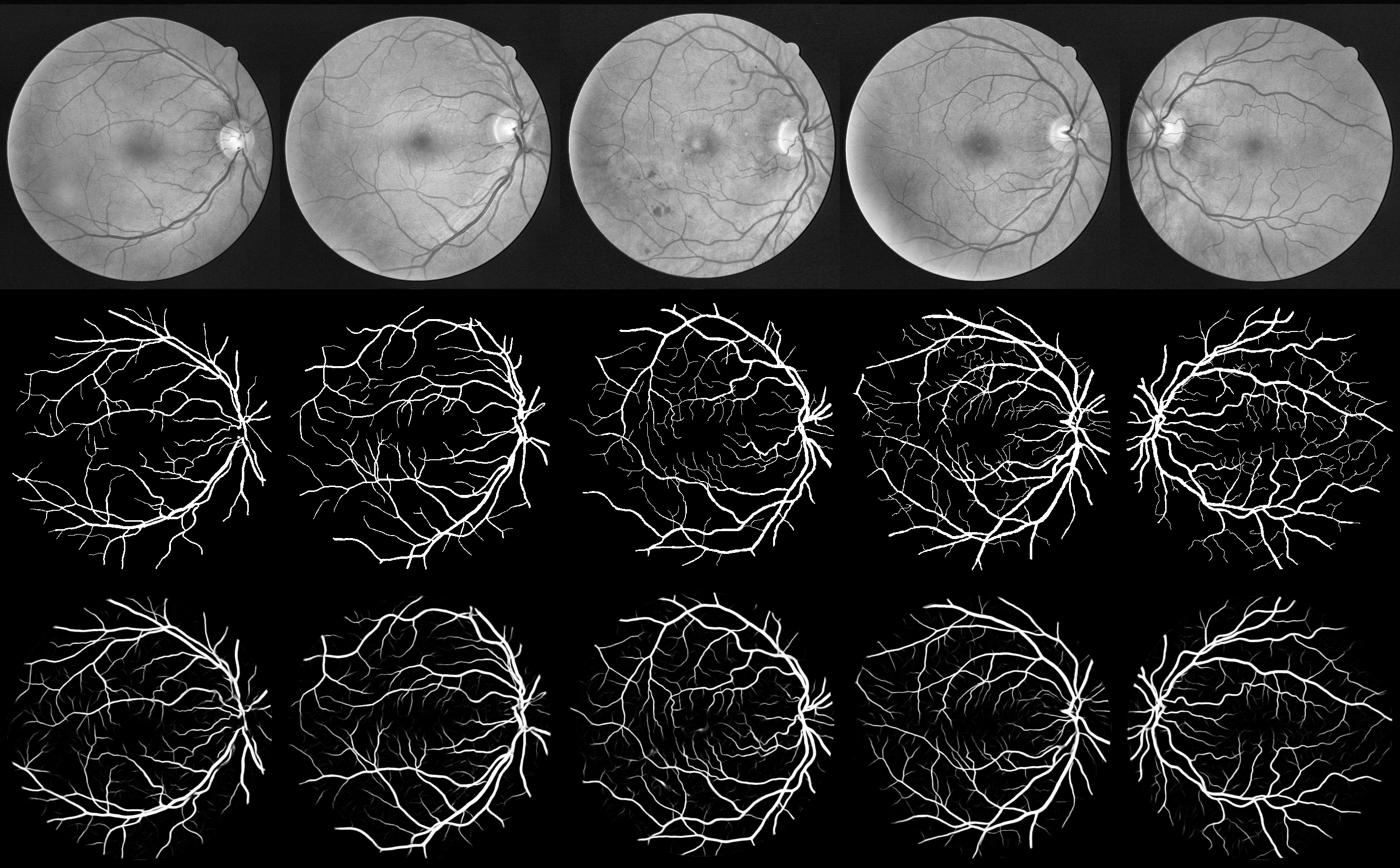 Retina Image Segmentation with UNet | my lab